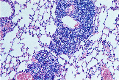 Color Atlas of Neoplastic and Non-neoplastic Lesions in Aging Mice ...