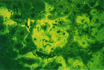 Color Atlas of Neoplastic and Non-neoplastic Lesions in Aging Mice ...