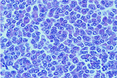 Color Atlas of Neoplastic and Non-neoplastic Lesions in Aging Mice ...