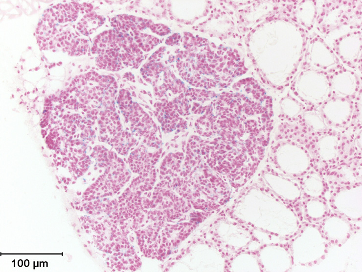 Gria3 In situ reporter (knock in) Gene Expression Assay - GXD
