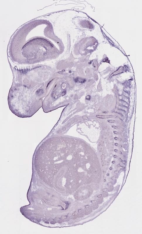 Dlx5 RNA in situ Gene Expression Assay - GXD