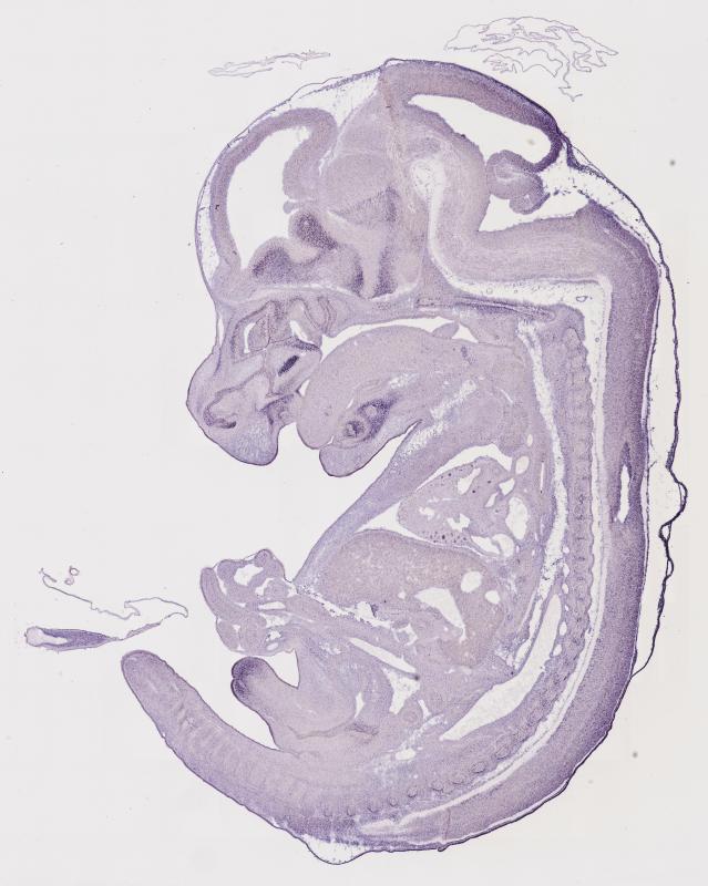 Dlx5 RNA in situ Gene Expression Assay - GXD