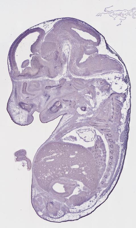 Dlx5 RNA in situ Gene Expression Assay - GXD